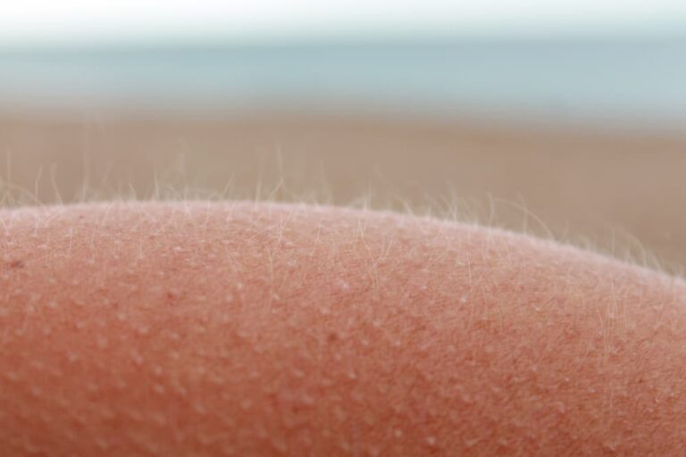 All About Dog Hackles | Great Pet Care